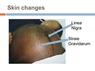 Changes of pregnancy | PPTX