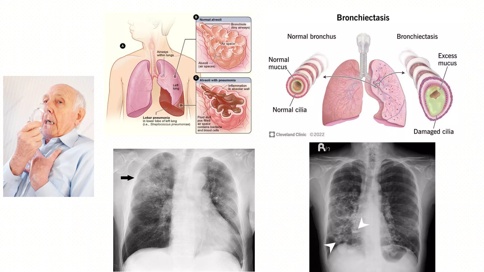 Changing positions and giving exercises for bed ridden.pdf