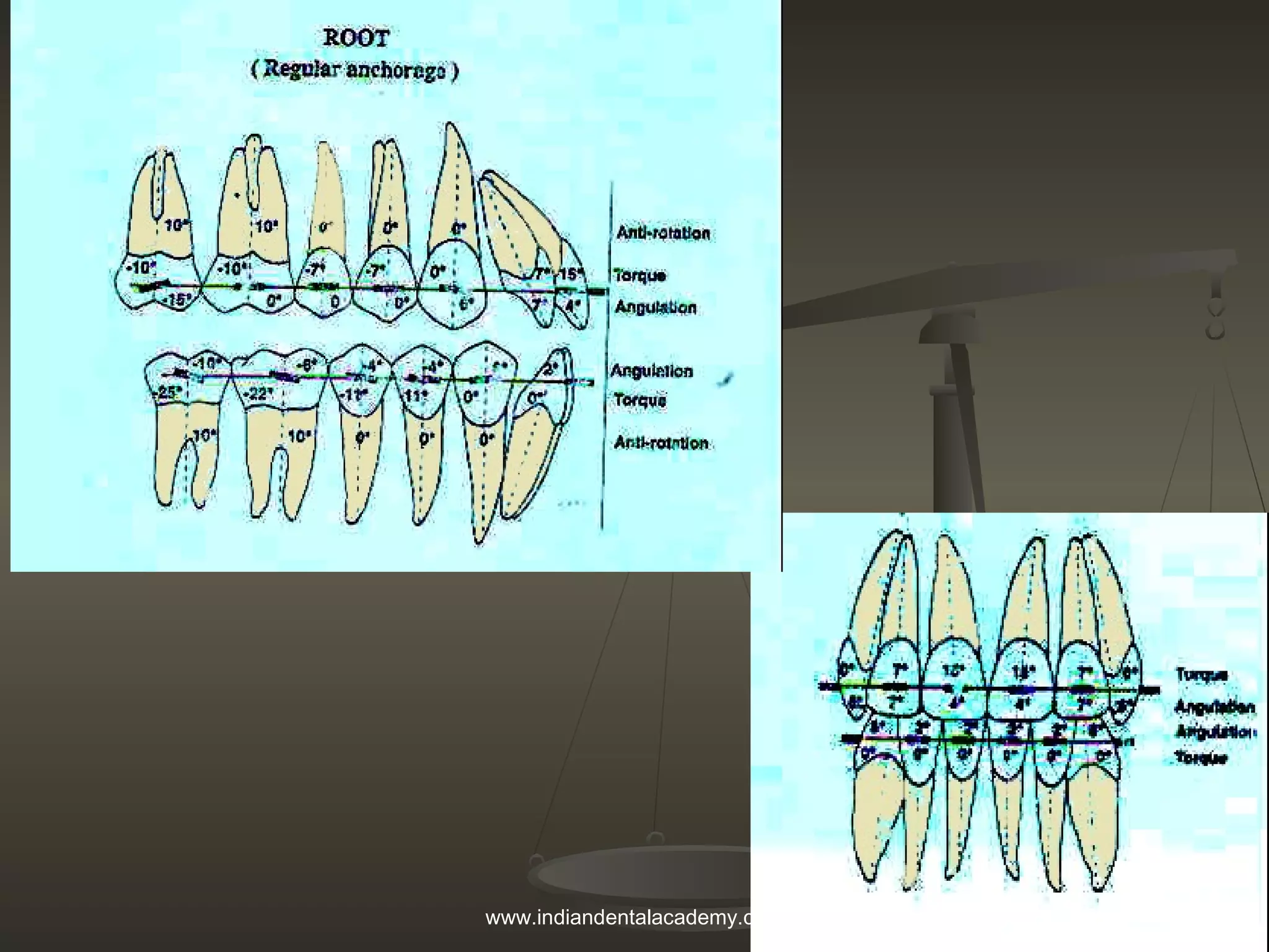 Changing trends in preadjusted edgewise system /certified fixed ...