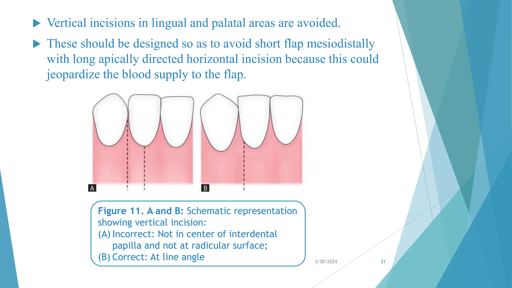 CHAN JOHN PERIO.pptx periodontal flap ppt | PPTX