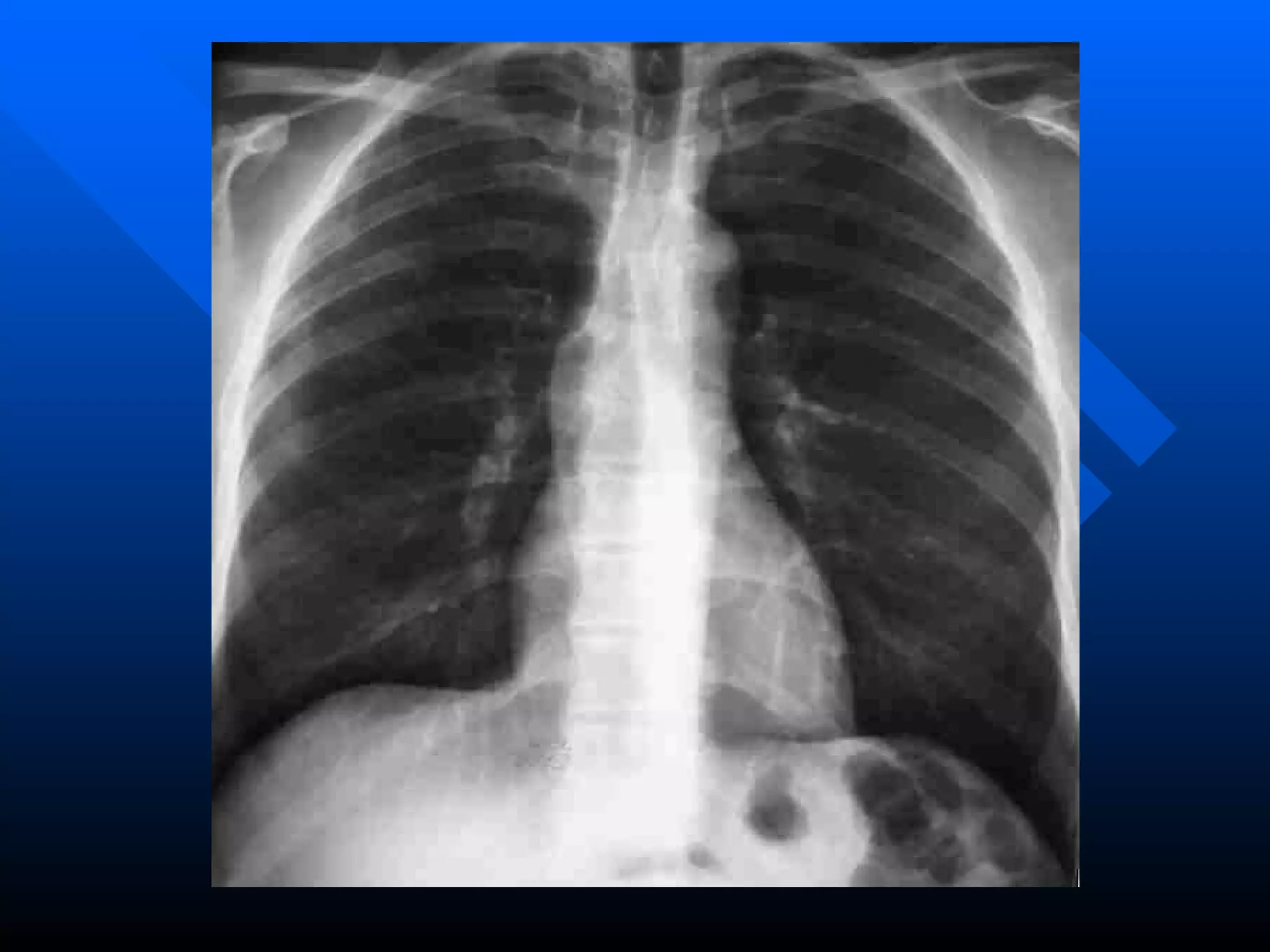 Pulmonary Imaging | PPT
