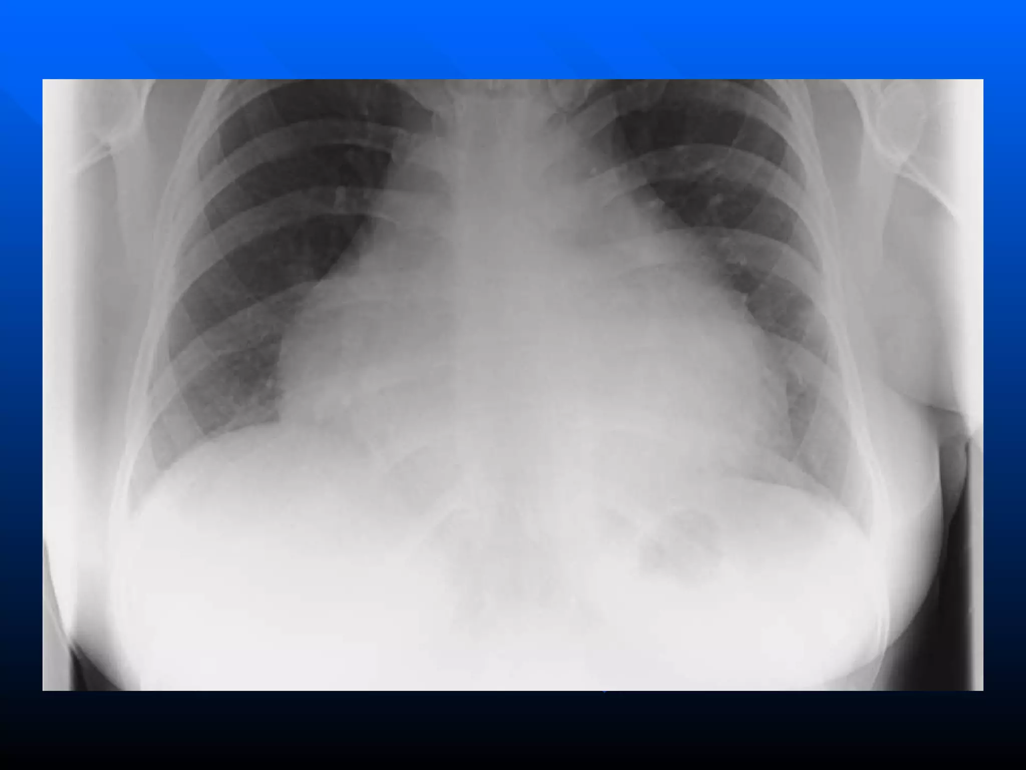 Pulmonary Imaging | PPT