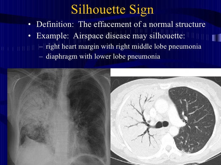 Pulmonary Imaging