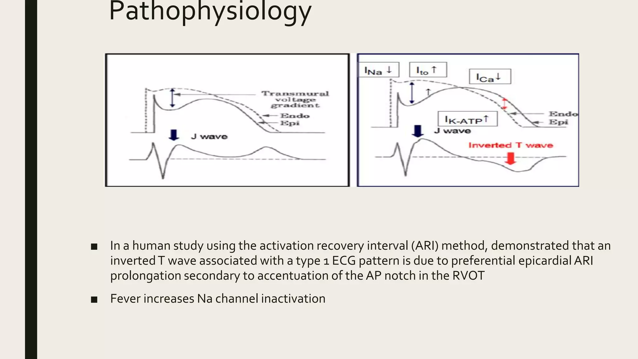 Cardiac Channelopathies | PPTX
