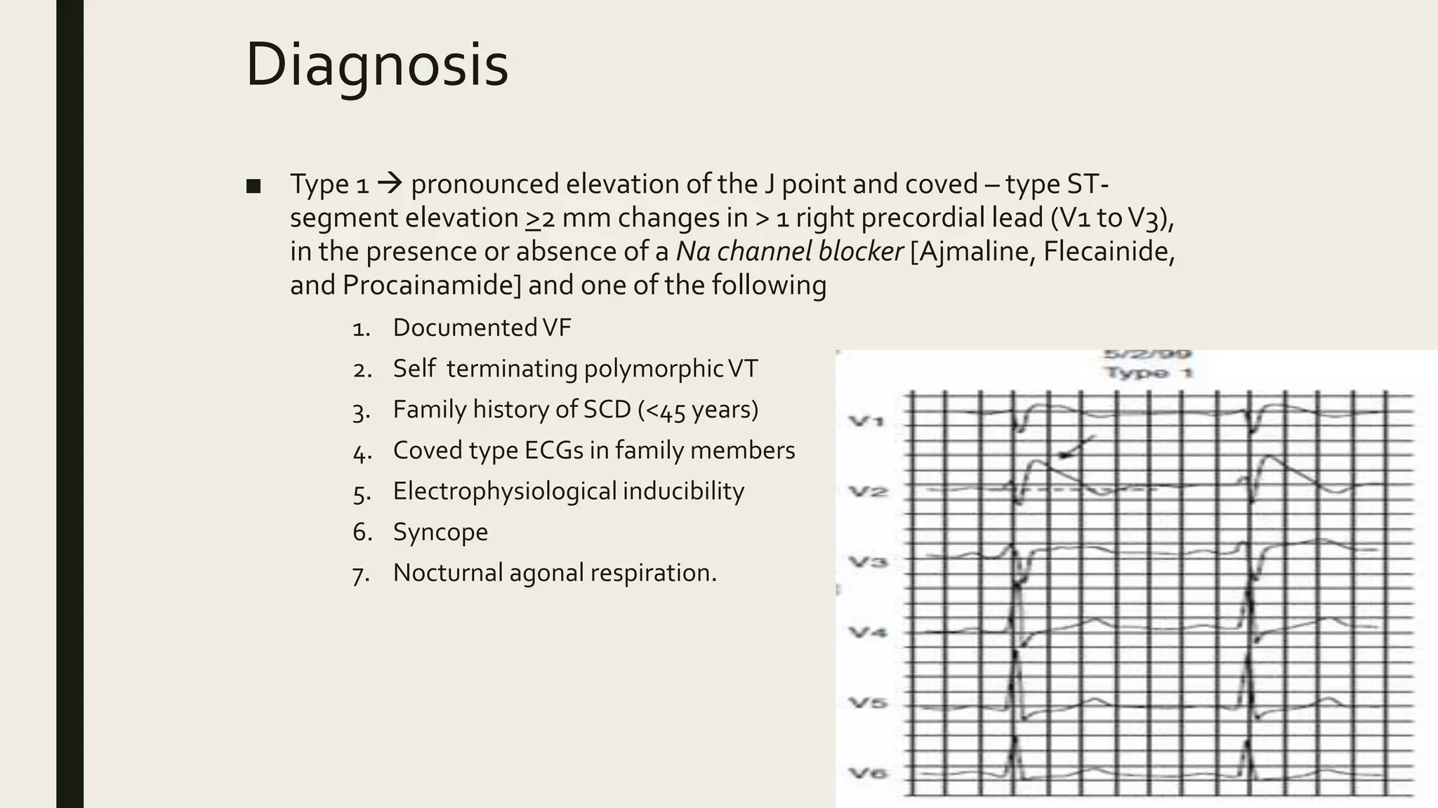 Cardiac Channelopathies | PPTX
