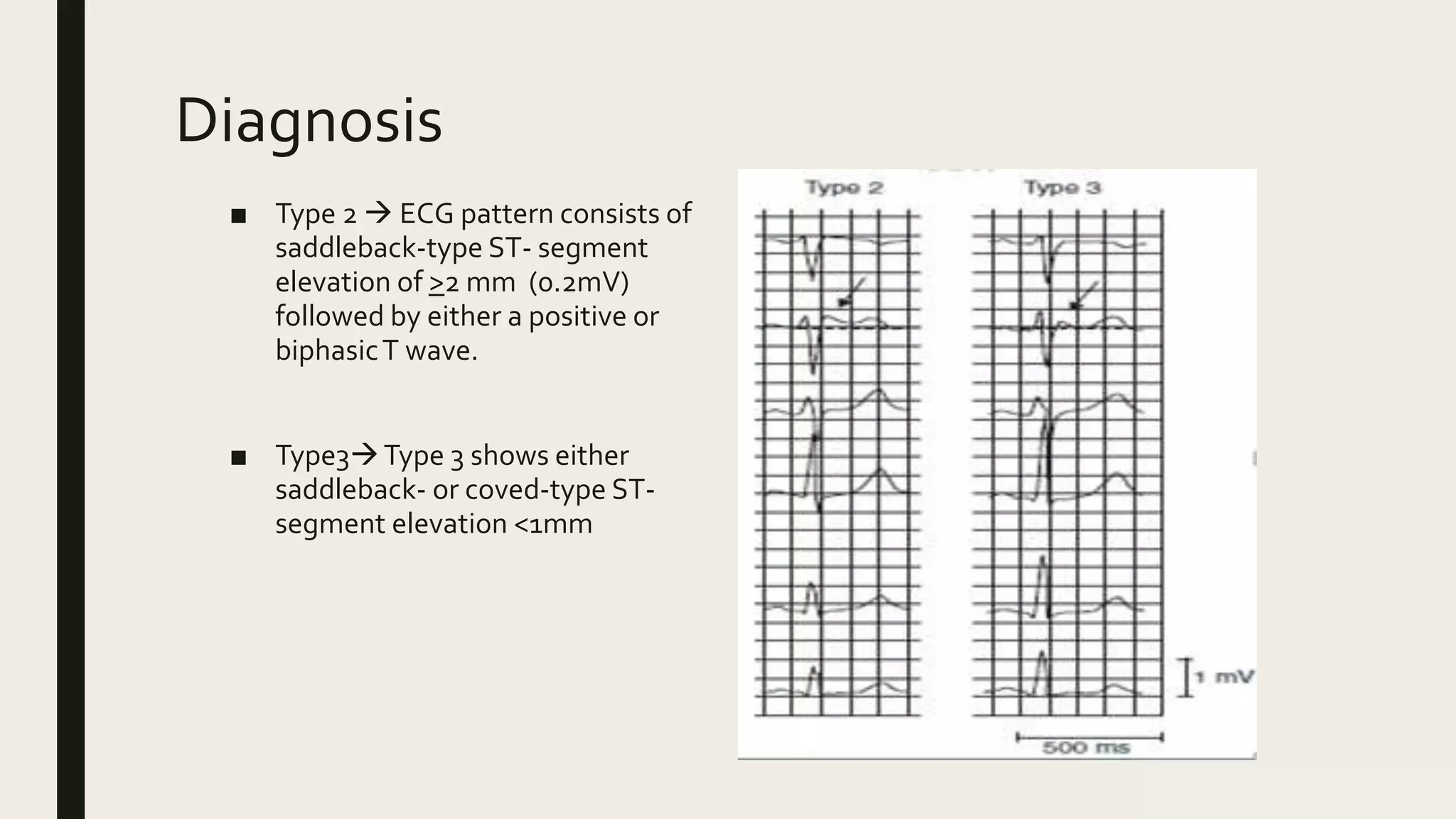 Cardiac Channelopathies | PPTX