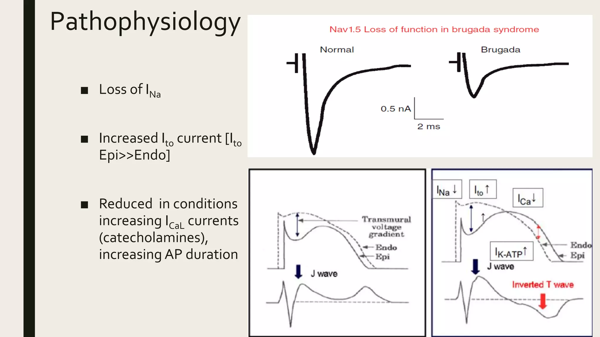 Cardiac Channelopathies | PPTX