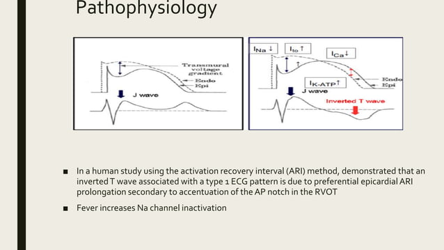 Cardiac Channelopathies | PPT