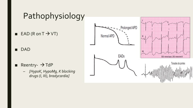 Cardiac Channelopathies | PPT
