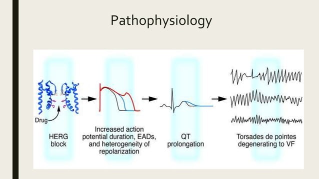 Cardiac Channelopathies | PPT