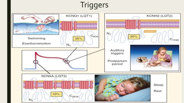 Cardiac Channelopathies | PPT