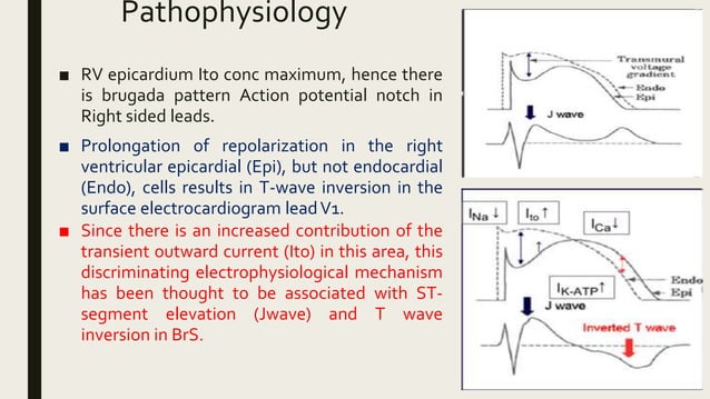 Cardiac Channelopathies | PPT