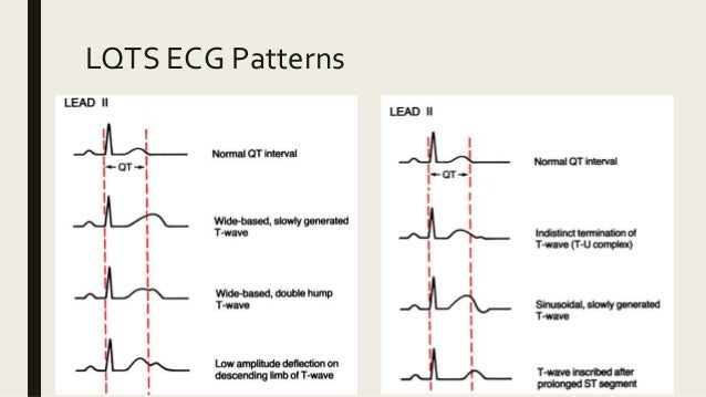 Cardiac Channelopathies