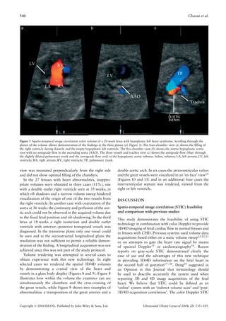 Chaoui et al-2004-ultrasound_in_obstetrics_&_gynecology | PDF