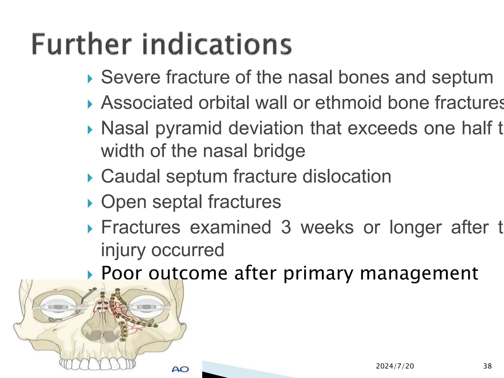 chap-3d fracture of nasal bone maxillofacial surgery.pptx