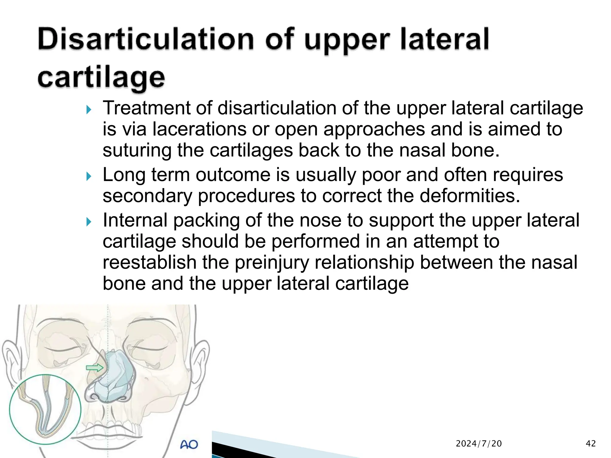 chap-3d fracture of nasal bone maxillofacial surgery.pptx