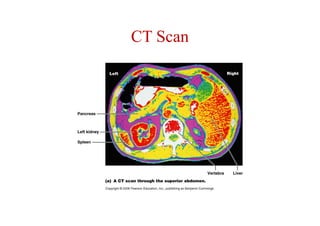 Chap1 anatomical terminology | PDF