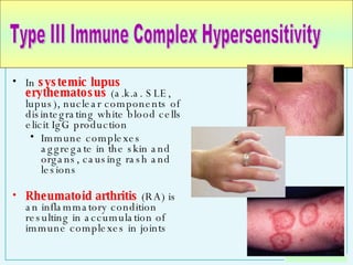 Chap21 Immune Disorders | PPT