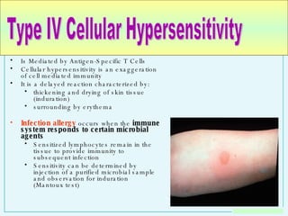 Chap21 Immune Disorders | PPT