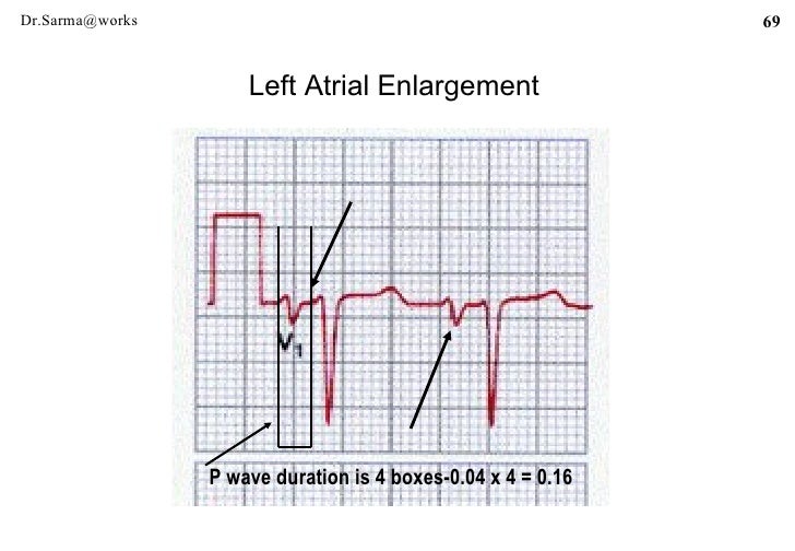 electrocardiogram