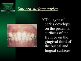 Chap3 Edited | PPT | Free Download