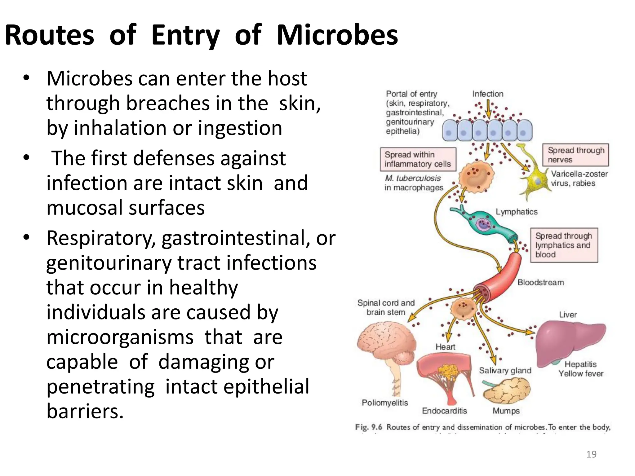chap 5 infectious diseases ( pathology) .pdf