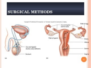 Chapt22 reproductive | PPT