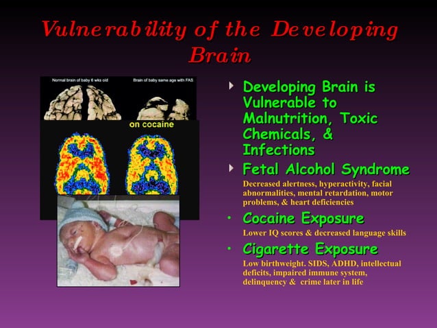 Chapter 05: Development & Plasticity of the Brain | PPT