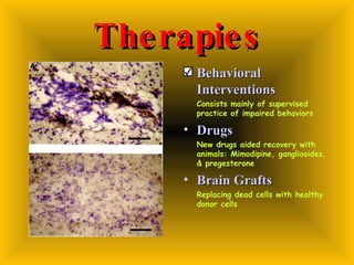 Chapter 05: Development & Plasticity of the Brain | PPT