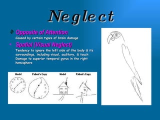 Chapter 07: Other Sensory Systems & Attention | PPT