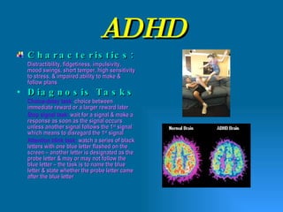 Chapter 07: Other Sensory Systems & Attention | PPT