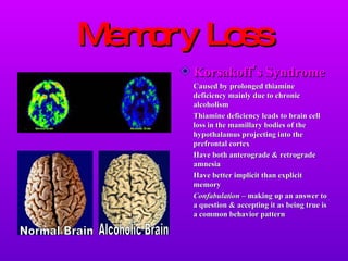 Chapter 13: The Biology of Learning & Memory | PPT