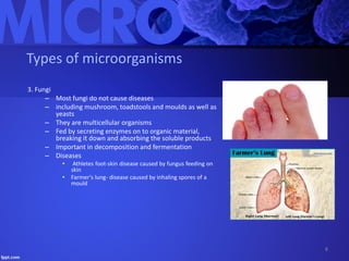 Edexcel IGCSE - Human Biology - Chapter 13 - Microorganisms and ...