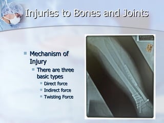 Muscles And Bones | PPT