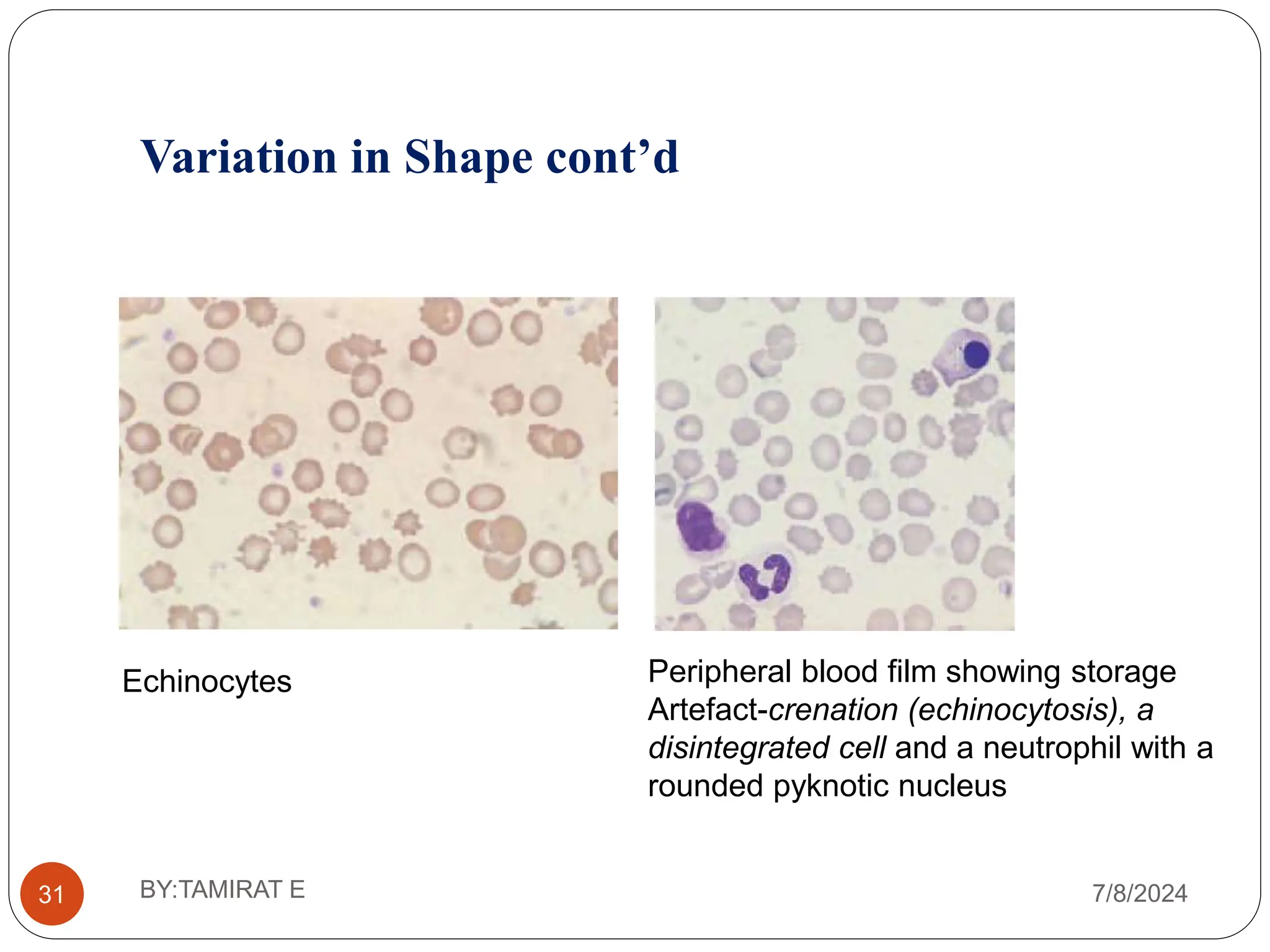 Cell disorder for hematology course.pptx