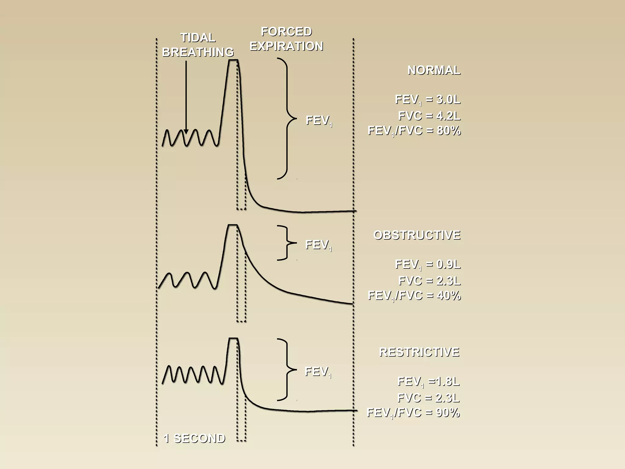 Respiratory #1, Pulmonary Ventilation - Physiology | PPT