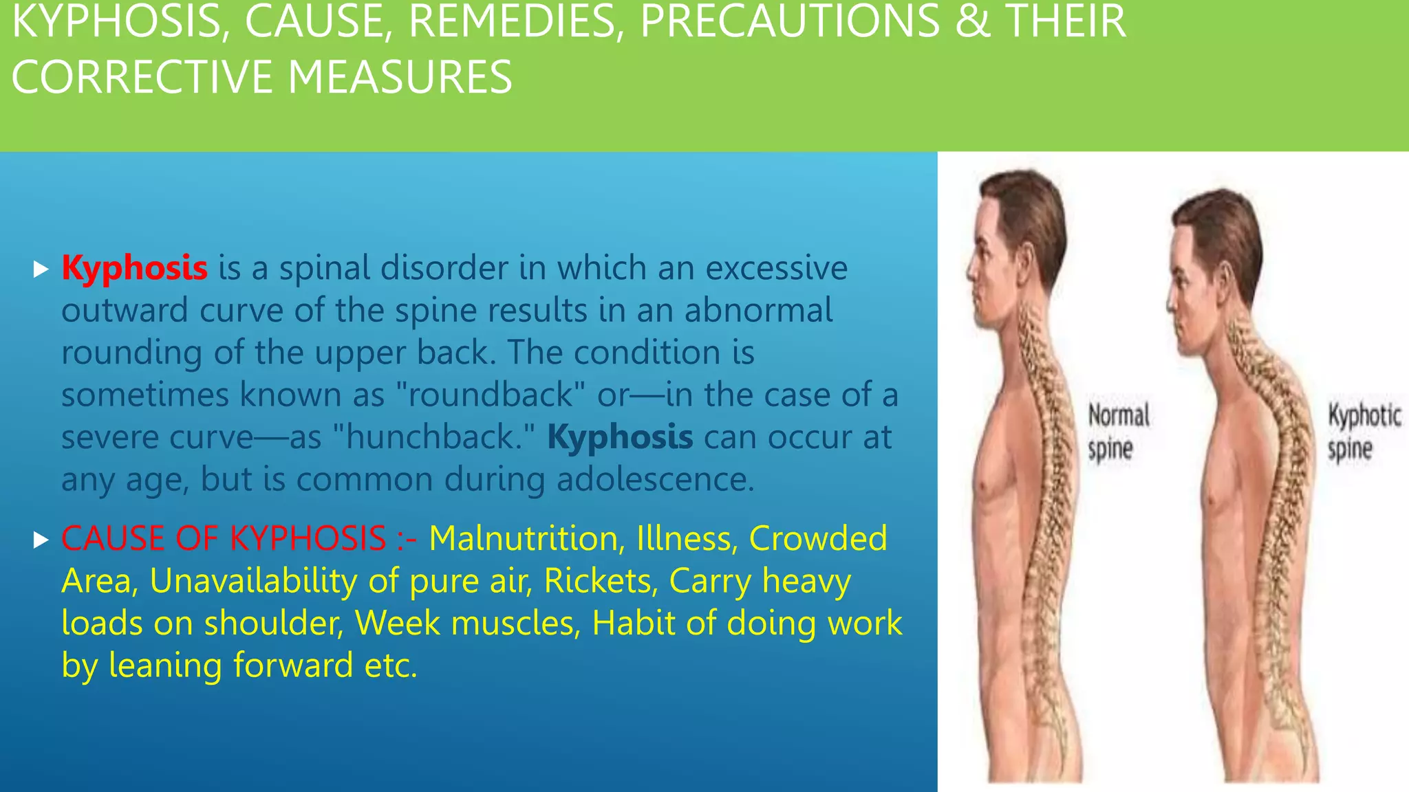 Chapter-2 XIIth Children and Women in Sports.pptx