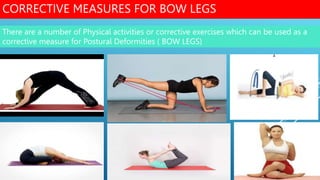 Chapter-2 XIIth Children and Women in Sports.pptx