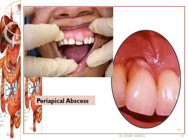 Chapter-7 GIT Disorders.ppt