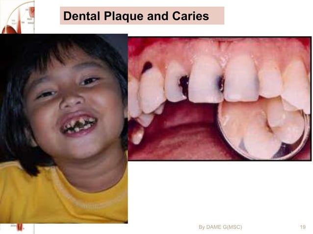 Chapter-7 GIT Disorders.ppt