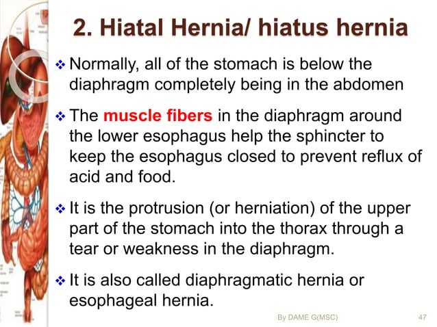 Chapter-7 GIT Disorders.ppt