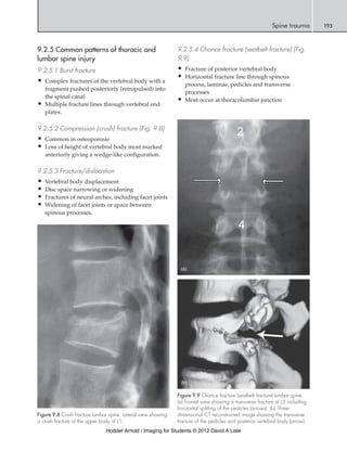 Chapter 9-spine | PDF