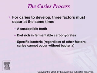 caries | PPT