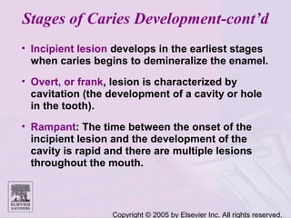 caries | PPT
