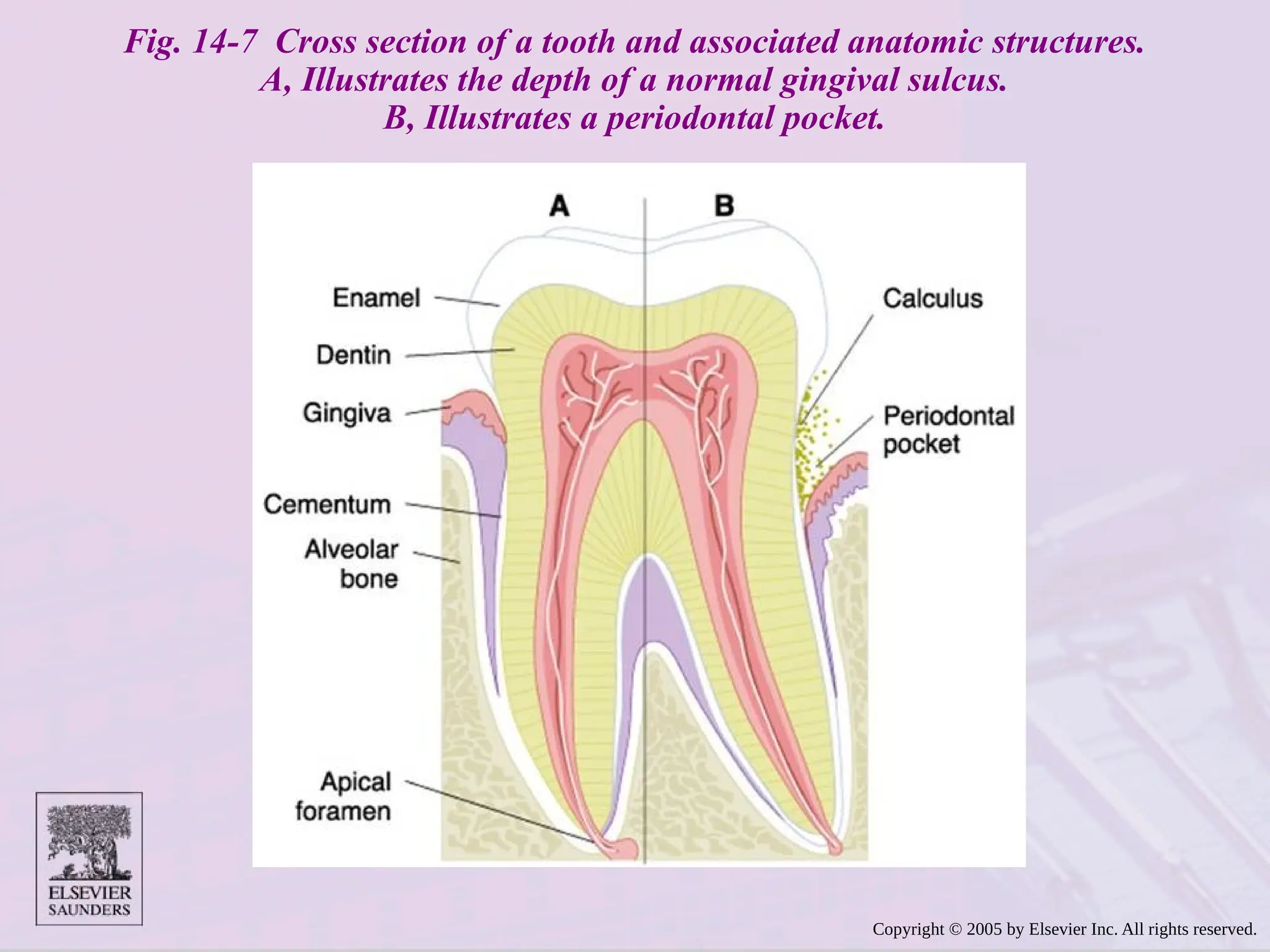 Chapter_014.ppt Periodontal diseases content | PPT