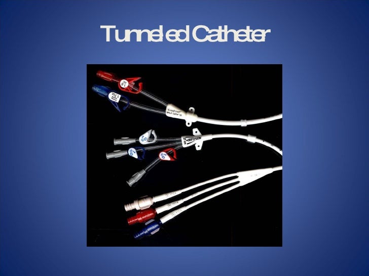 Chapter 015 infusion therapy