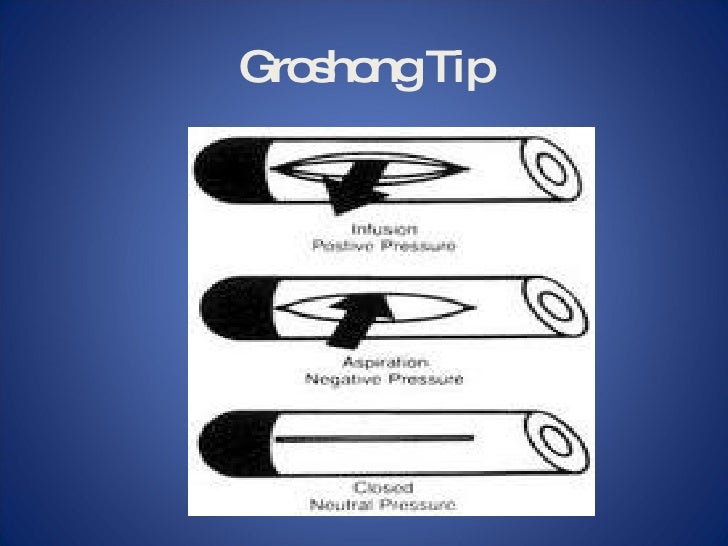 Groshong Catheter Tip