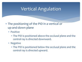 Chapter 19: Bitewing Technique | PPT