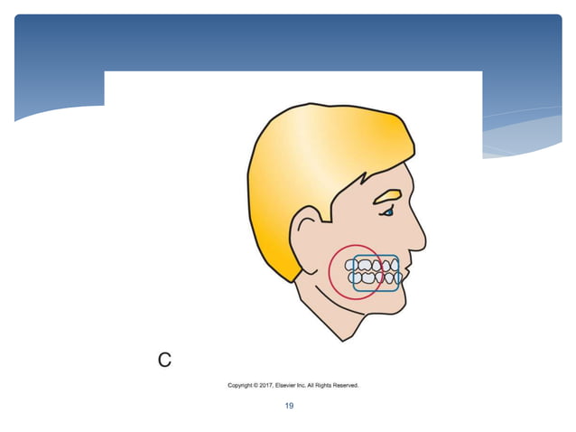 Chapter 19: Bitewing Technique | PPT | Dental Health | Diseases and ...