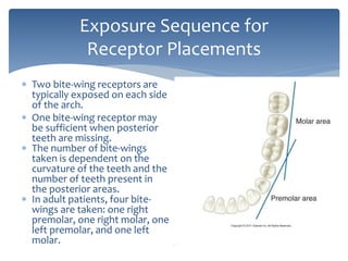 Chapter 19: Bitewing Technique | PPT